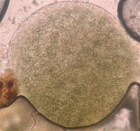 A Colony Of Cyanobacteria From A Sample I Closed Off About 6 Months Ago