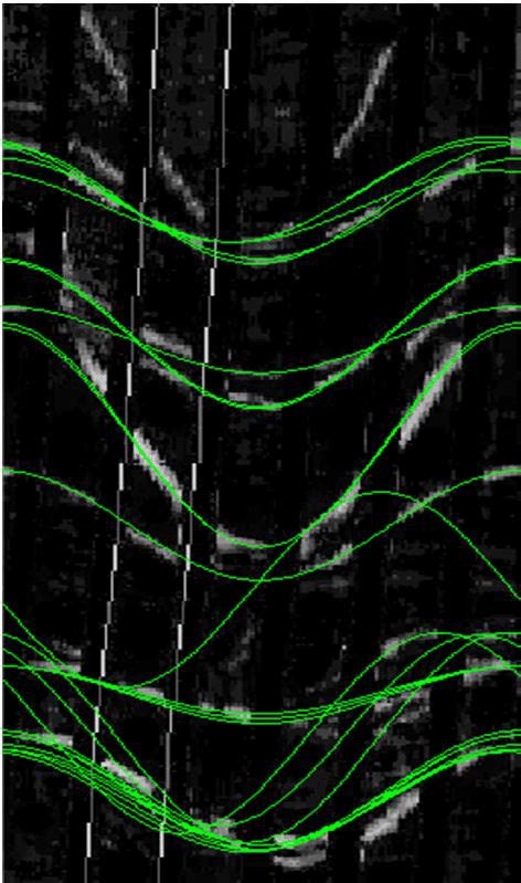 Hough Transform Is Applied On Binary Images A The Image With One