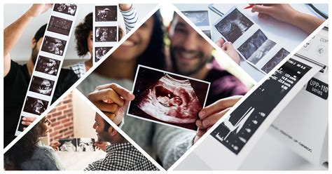 Sony Electronics Healthcare Solutions Us And Canada On Linkedin Our Efficient Ultrasound