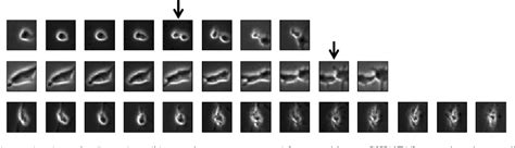 Figure 1 From Automated Mitosis Detection Of Stem Cell Populations In Phase Contrast Microscopy