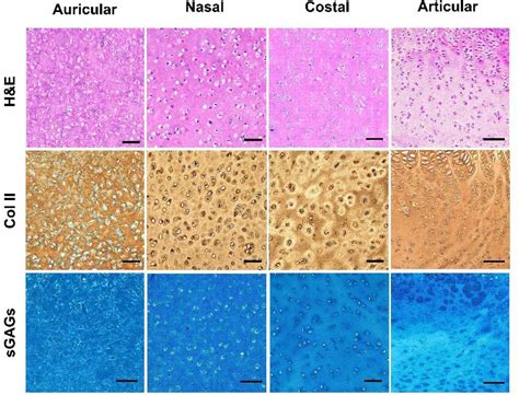 Ear Cartilage Histology