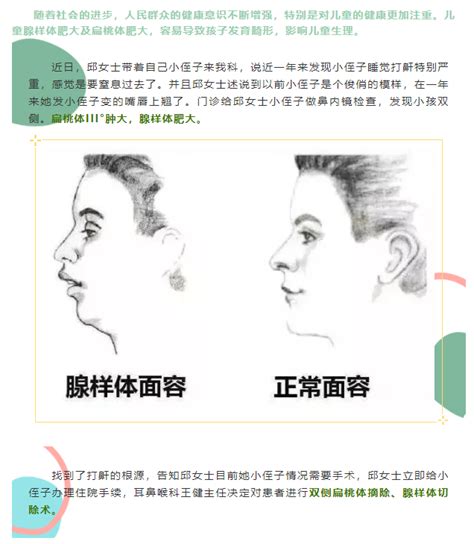 【医学科普】儿童睡觉打鼾，警惕腺体样肥大