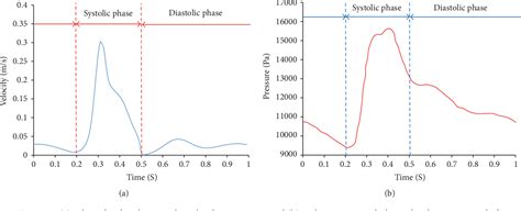 Figure 1 From Fluid Structure Interaction In Abdominal Aortic Aneurysm
