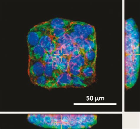 cell encapsulation and delivery · desai lab · ucsf