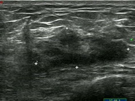 opencv remove the cross marks in the image in python stack overflow