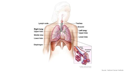 Metastatic Lung Cancer Cancerwalls