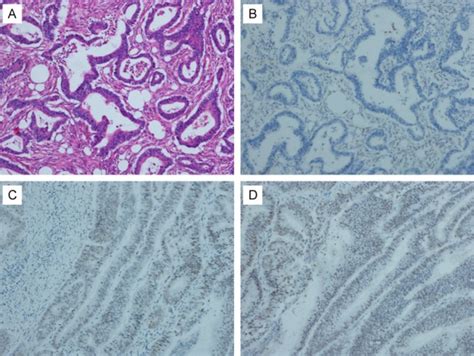 Comparison Of Microsatellite Status Detection Methods In Colorectal Carcinoma Pmc