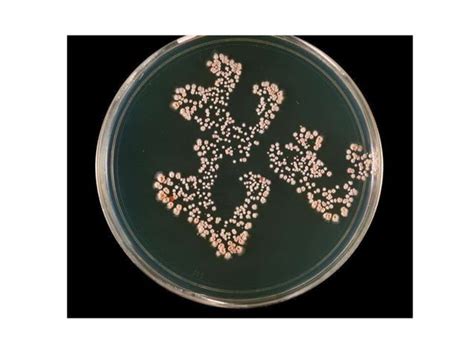 Nocardia PPTX Lung And Respiratory Health Diseases And Conditions