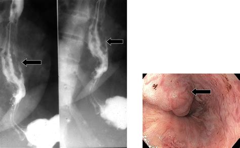 Dots Lines Contours And Ends An Image Based Review Of Esophageal