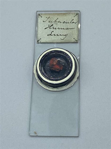 Antique Human Lung Section With Tuberculosis Tb Microscope Slide