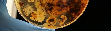 Battle Of Bacteria Klebsiella Vs Enterobacter Doccheck