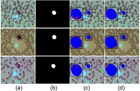 figure 13 from deep features aggregation based joint segmentation of