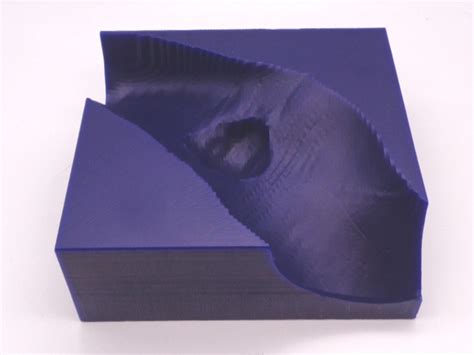 Decimal Bolus Electron Conformal Therapy Decimal Electron Bolus