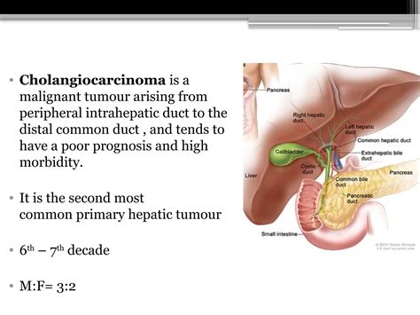 Cholangiocarcinoma Sudhan Radiological Imaging Pptx Digestive