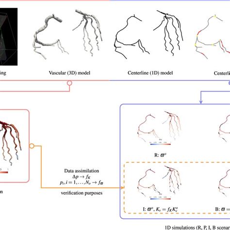 Workflow For The Construction Of Vascular Models Image Segmentation Download Scientific