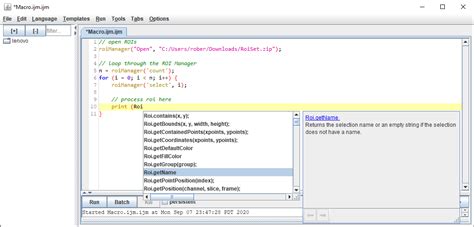 How To Loop Through Roisetzip In Imagej Macro Image Analysis Image