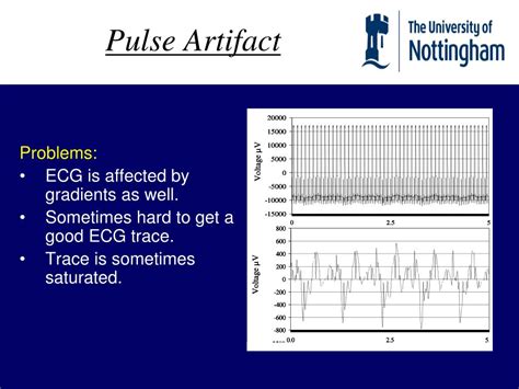 Ppt Simultaneous Eeg Fmri From Acquisition To Application Powerpoint Presentation Id3094539