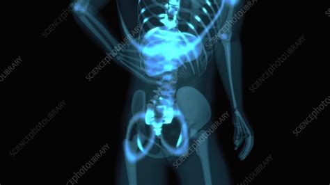 Liver Disease Conceptual Illustration Stock Image F042 3104