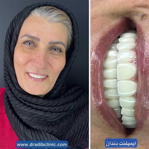 گالری دندانپزشکی دکتر ادیب