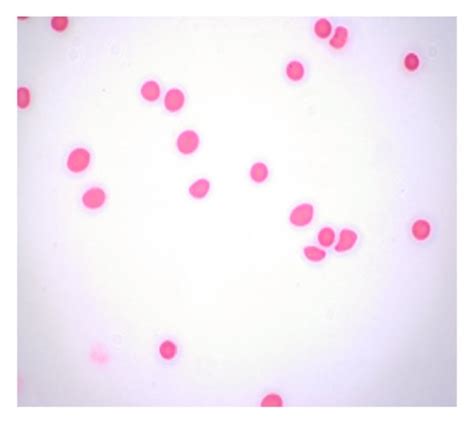 Erythrocyte Observed With Light Microscope After Wrights Staining
