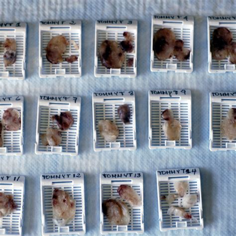 Importance Of Proper Orientation During Embedding Left Gross Download Scientific Diagram