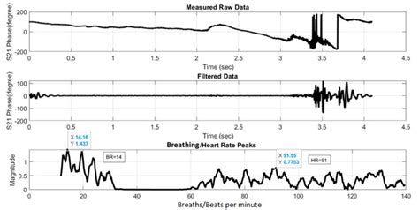 Hrbr Measurement Of Subject 1 Using Four Element Array Hr 91 Br 14 Download Scientific