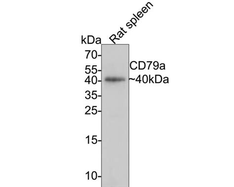 Huabio Research Inc Anti Cd79a Antibody C1 E8 Quantity Each Of 1