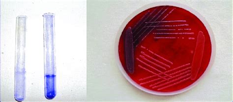 Biofilm Detection By Tube Method And Congo Red Agar Method Download Scientific Diagram