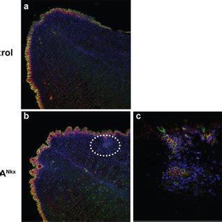 Tumor Cells Are Detected At E17 5 In Mouse Tongue Immunofluorescence