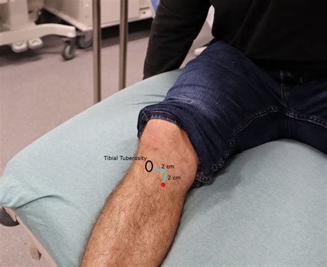 Intraosseous Line Emergency Medicine Training