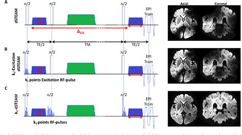 Figure 1 From Ultra High Resolution And Multi Shell Diffusion Mri Of