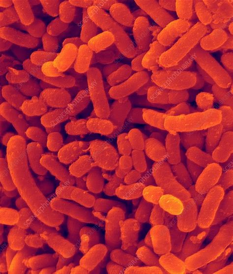 Prevotella Melaninogenica Sem Stock Image C0321895 Science