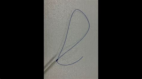 Endoscopic Endoloop At Erik Walker Blog