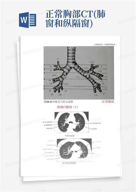 正常胸部ct肺窗和纵隔窗word模板下载编号qegyannp熊猫办公