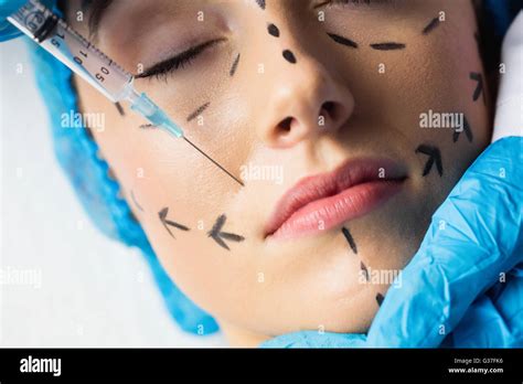 Botox Injection Hi Res Stock Photography And Images Alamy