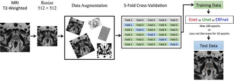 figure 1 from deep learning based methods for prostate segmentation in