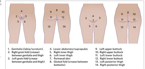 Pdf Proceedings Of The Global Iad Expert Panel Incontinence