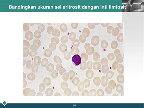 Ppt Gangguan Eritrosit Anemia Powerpoint Presentation Free Download Id 2128682