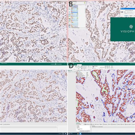 Automated Workflow Of Er Ihc Digital Imaging Analysis Dia Using Download Scientific Diagram Automated Workflow Of Er Ihc Digital Imaging Analysis Dia Using Download Scientific Diagram