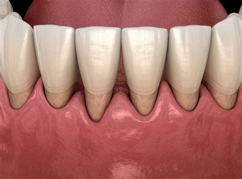 A Guide To The New BSP Classification Revise Dental