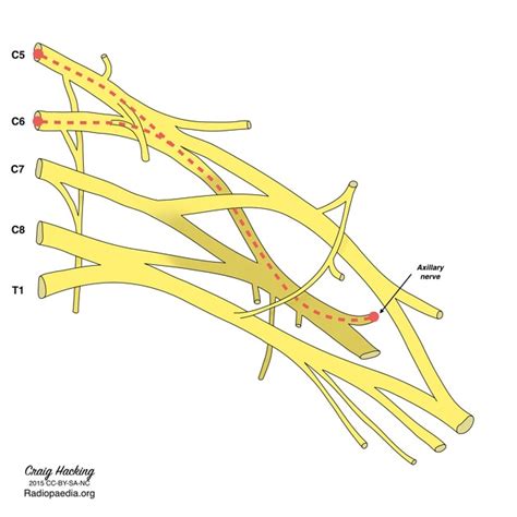 Axillary Plexus