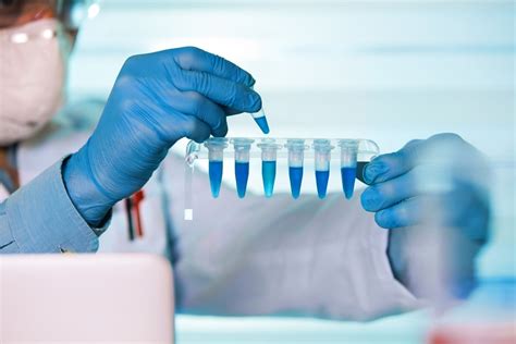 Improving Automated Nmr Integration Through Deep Learning