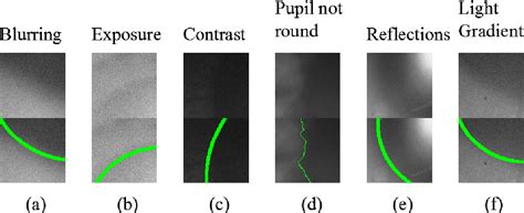 figure 4 from non intrusive practitioner pupil detection for unmodified