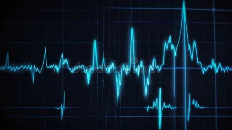 A Digital Display Shows A Blue Electrocardiogram Ecg Waveform On A Dark Background Stock