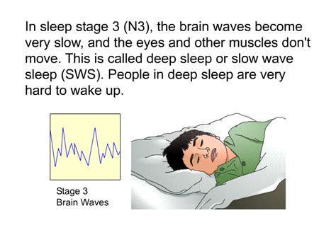 Sleep Disorders