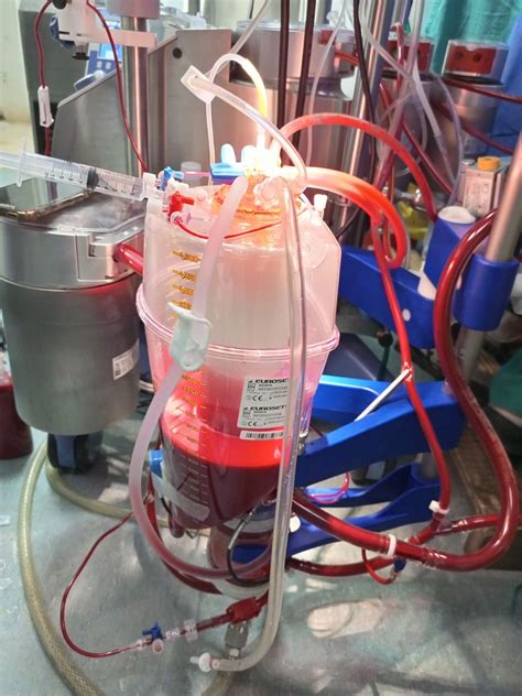 Bypass Tof Cardiacperfusion Perfusion Maryam Asaad