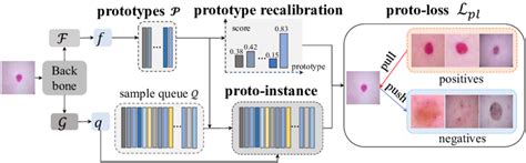 Our Proposed Prototype Aware Contrastive Learning Proco Framework F