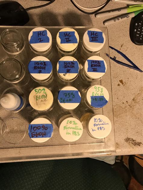 Trying My Hand At Paraffin Embedding Some Botanical Samples R Microscopy