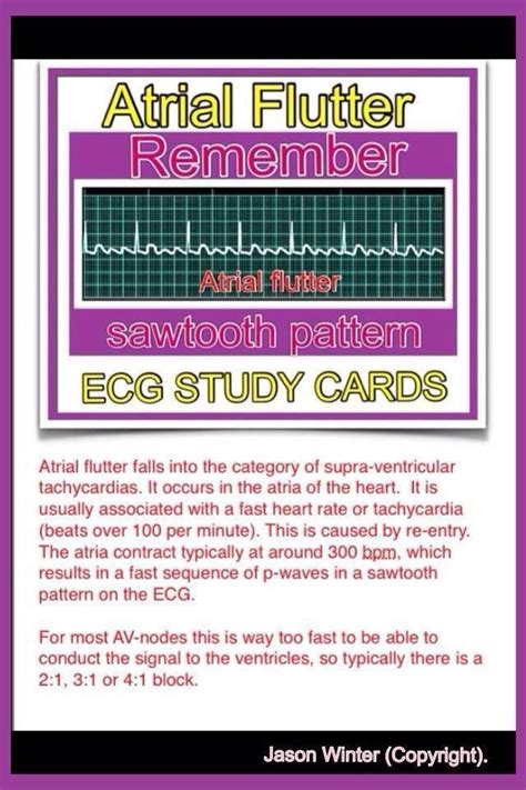 Atrial Flutter Artofit