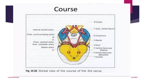 Vertical Deviation Pptx
